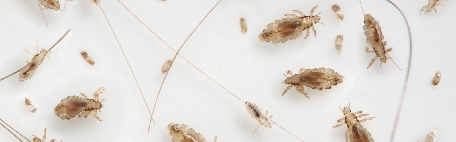 What Parents Need to Know About Head Lice - Updated for 2024 - Pests.org